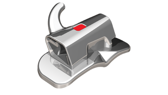 Buccal Tubes — Smile Stream Solutions